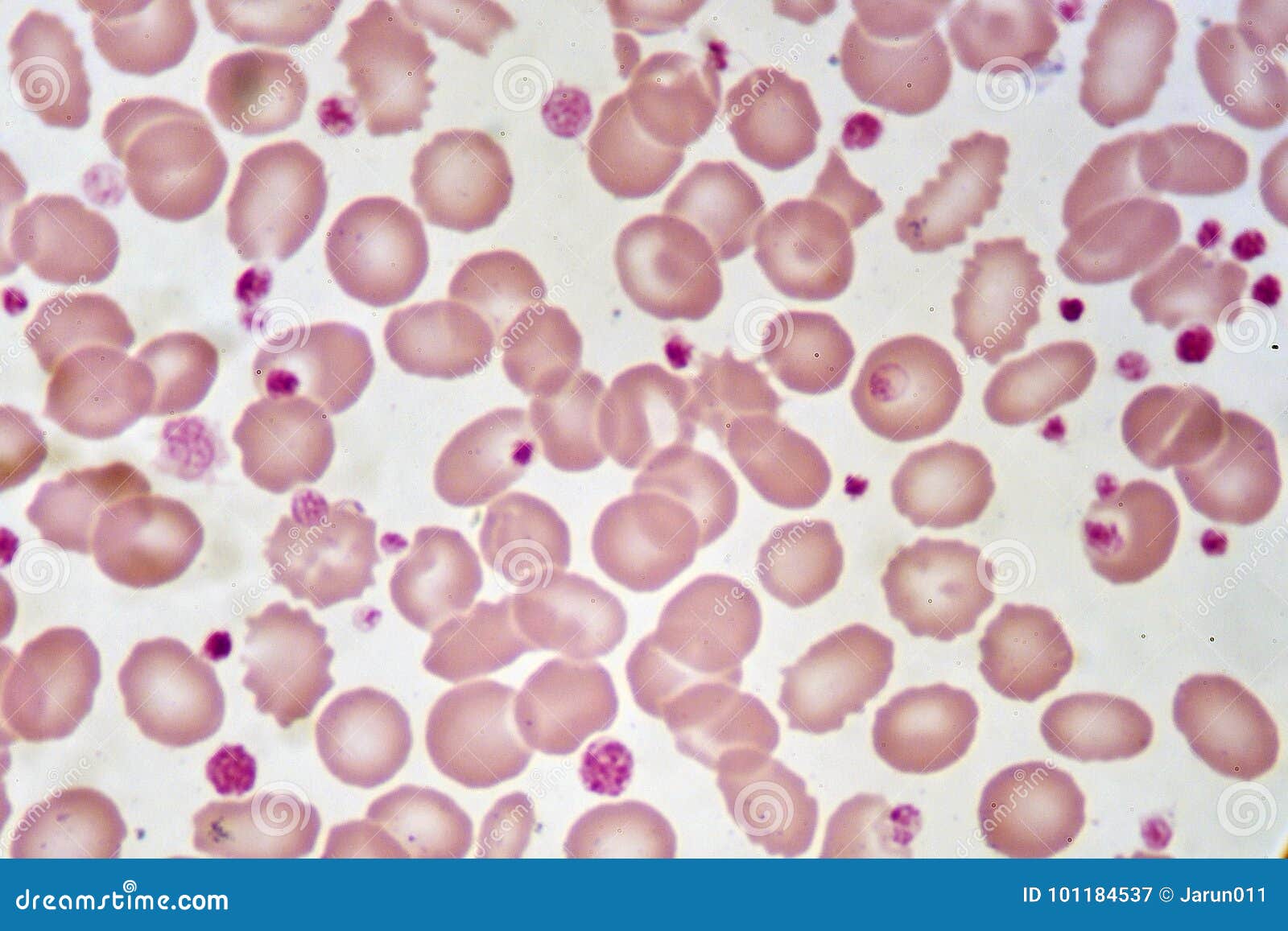 Rode bloedcellen stock afbeelding. Image of volledig - 101184537