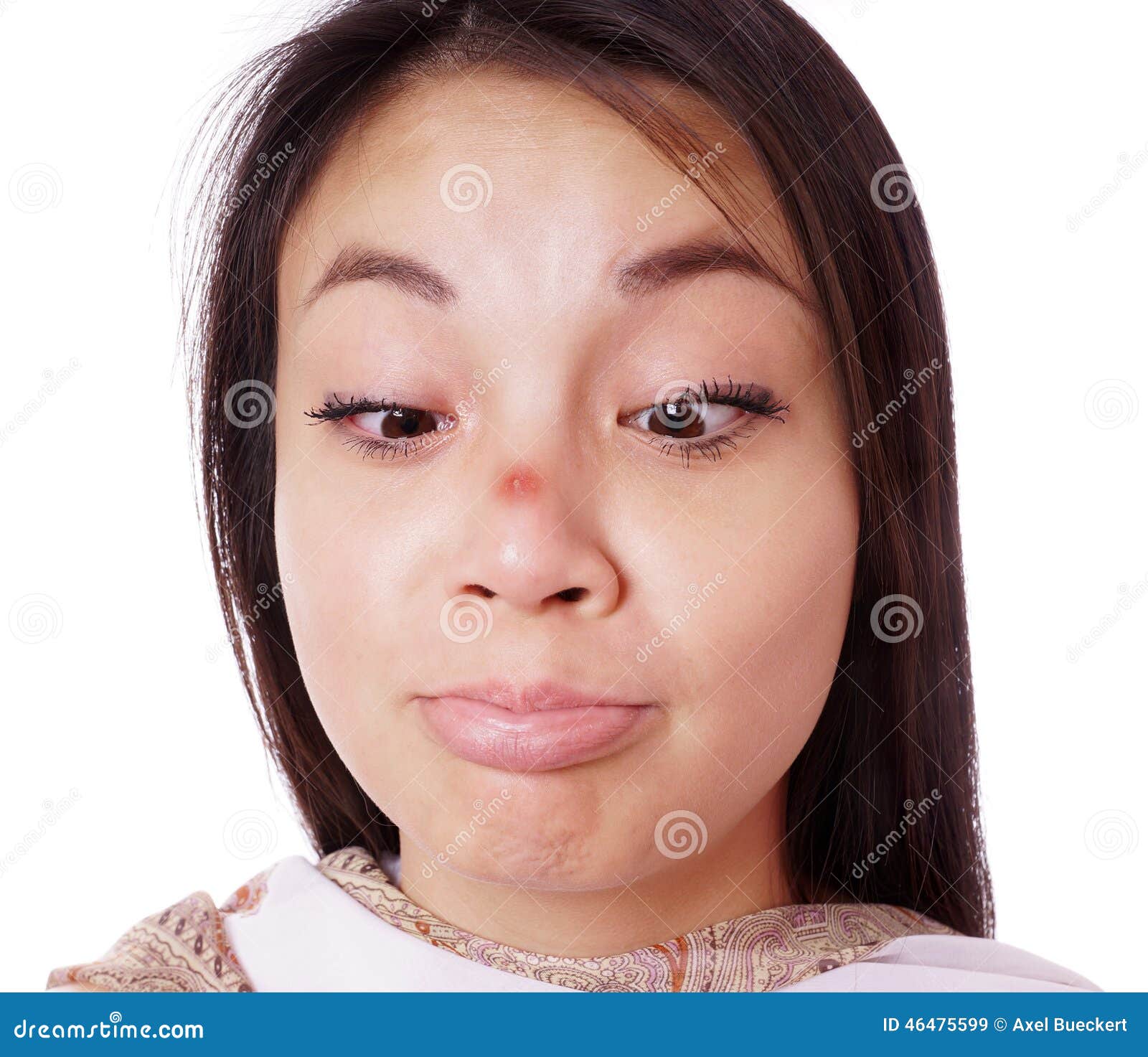 Rode pukkel op neus stock afbeelding. Image of zwarte - 46475599