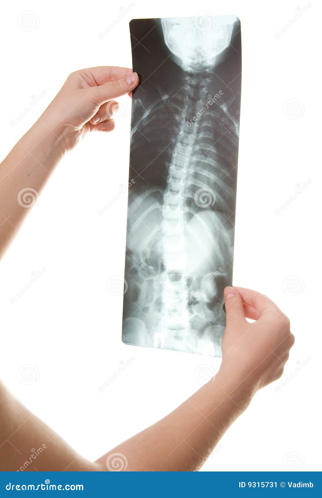 Roentgen stock image. Image of thorax, medicine, diagnostics - 9315731