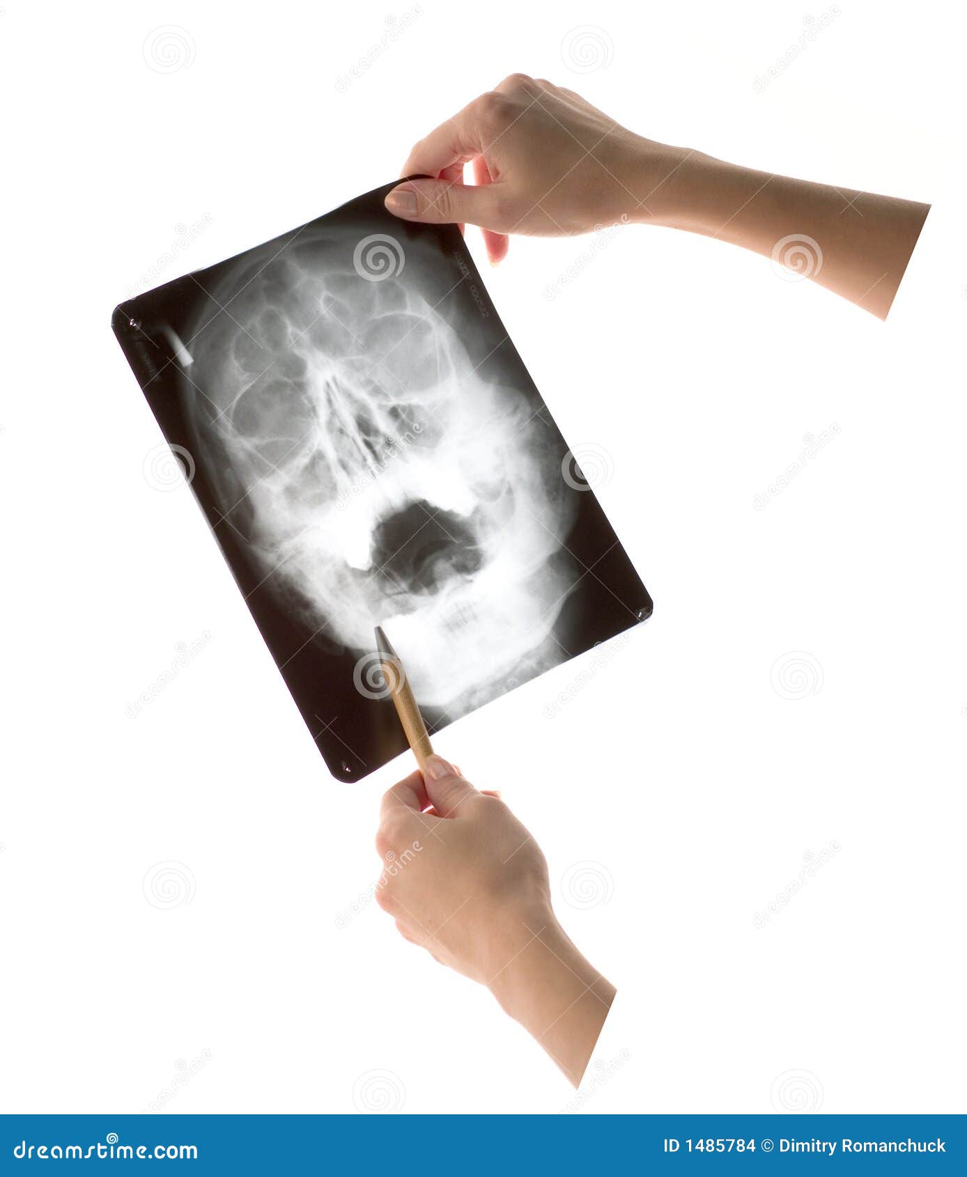 Roentgenogram stock photo. Image of health, xray, skeleton - 1485784