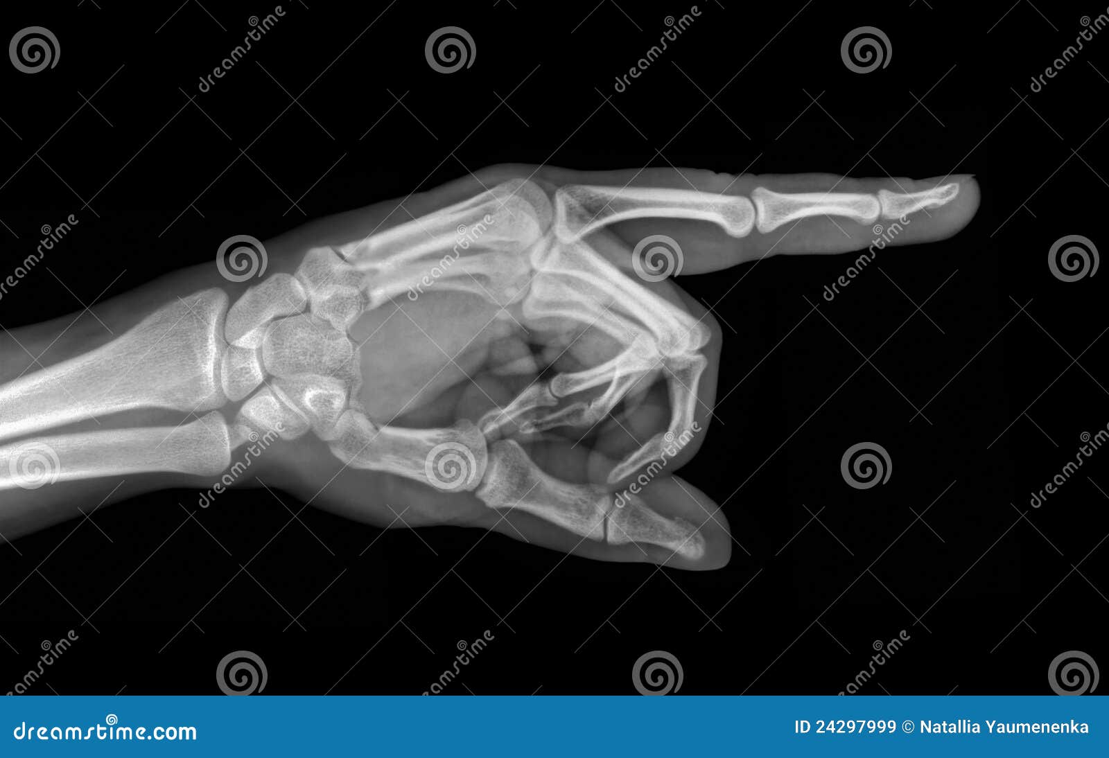 Roentgenogram stock image. Image of black, pointing, limb - 24297999