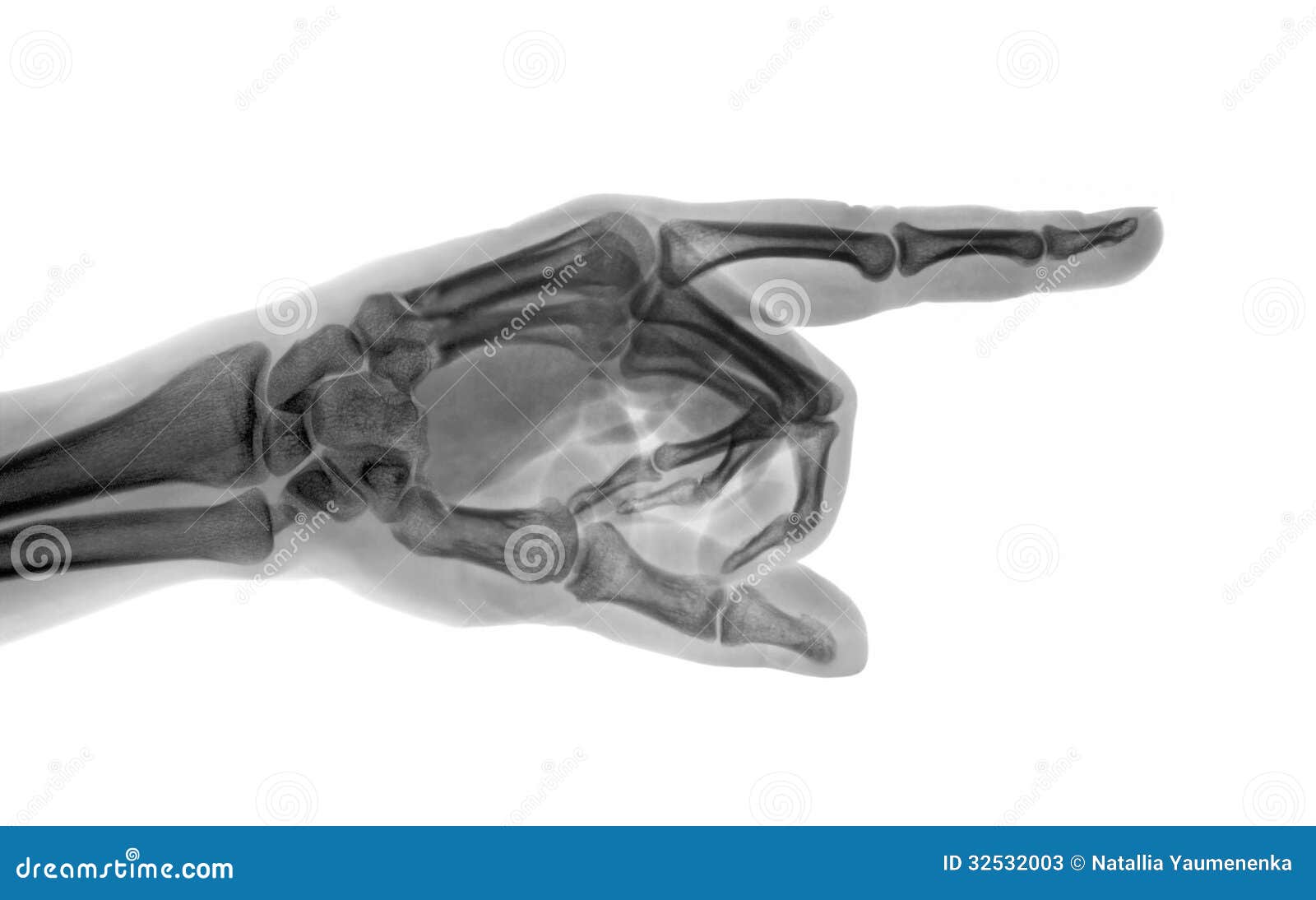 Roentgenogram stock image. Image of background, cancer - 32532003