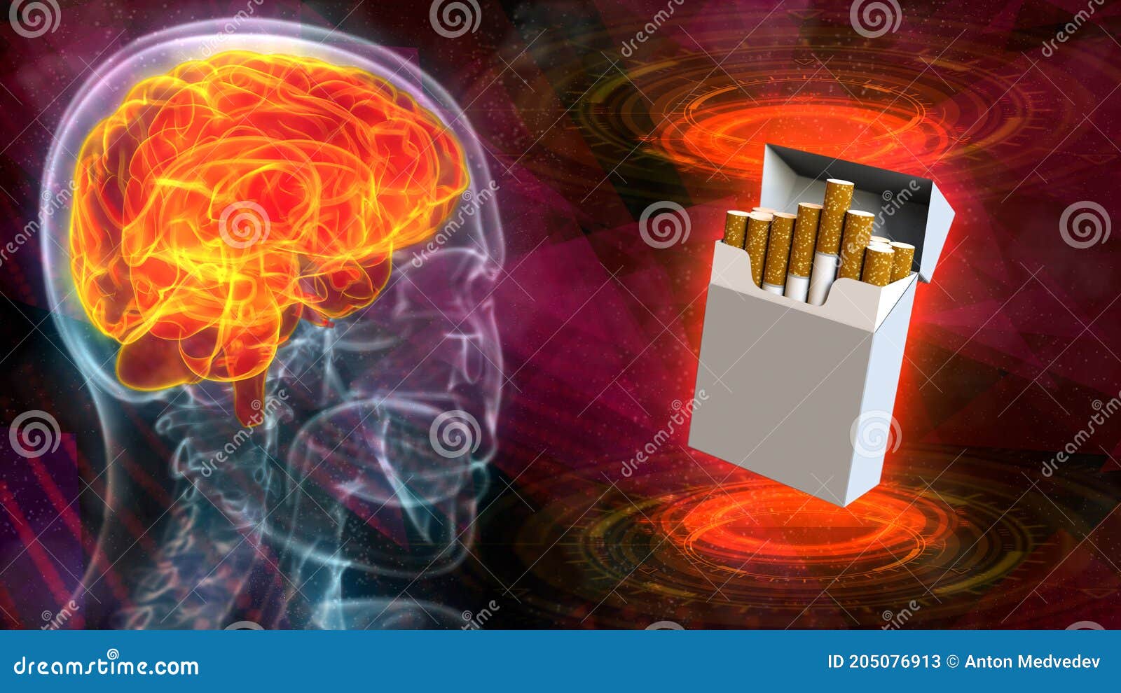 Medical 3D Illustration - Rontgen Human Head Image with Highlighted ...
