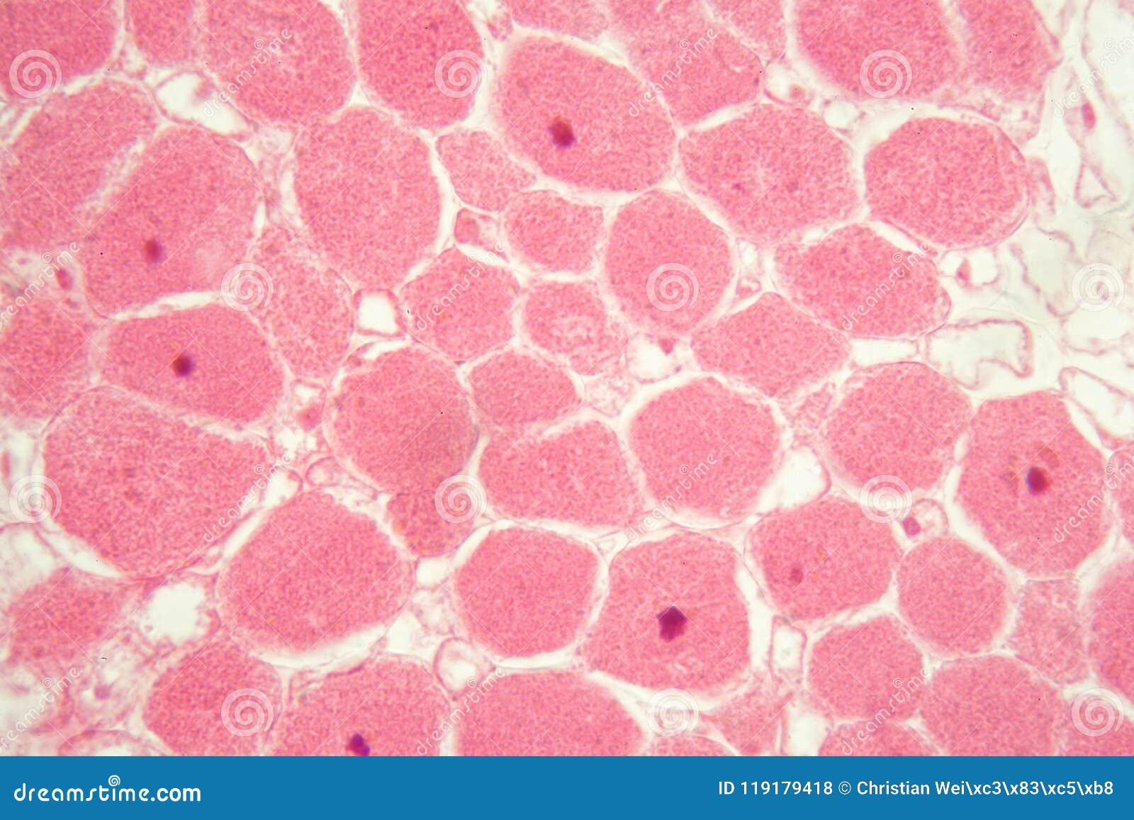 Root Bacteria Nodules Under the Microscope. Stock Photo - Image of ...