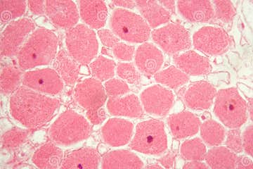 Root Bacteria Nodules Under the Microscope. Stock Photo - Image of ...