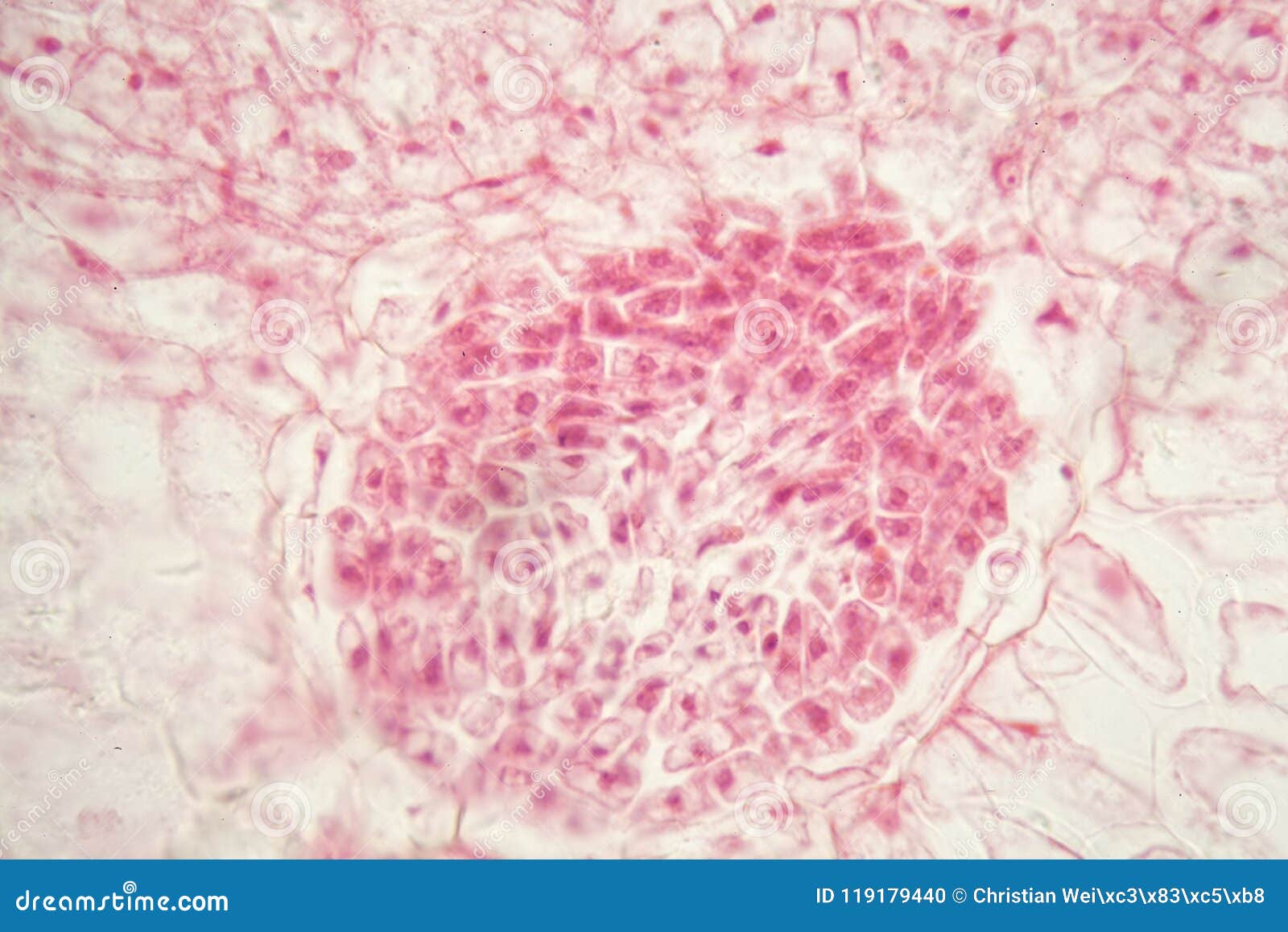 Root Bacteria Nodules Under the Microscope. Stock Photo - Image of knot ...