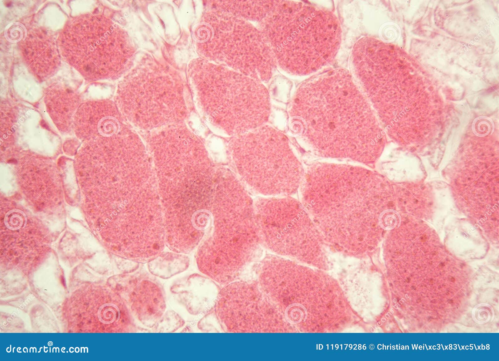 Root Bacteria Nodules Under The Microscope. Stock Photography ...