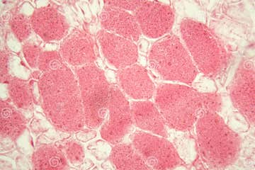 Root Bacteria Nodules Under the Microscope. Stock Photo - Image of grow ...