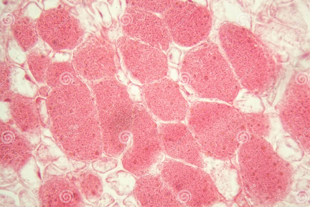 Root Bacteria Nodules Under the Microscope. Stock Photo - Image of grow ...