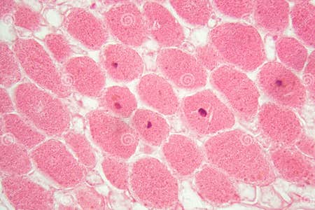 Root Bacteria Nodules Under the Microscope. Stock Photo - Image of ...