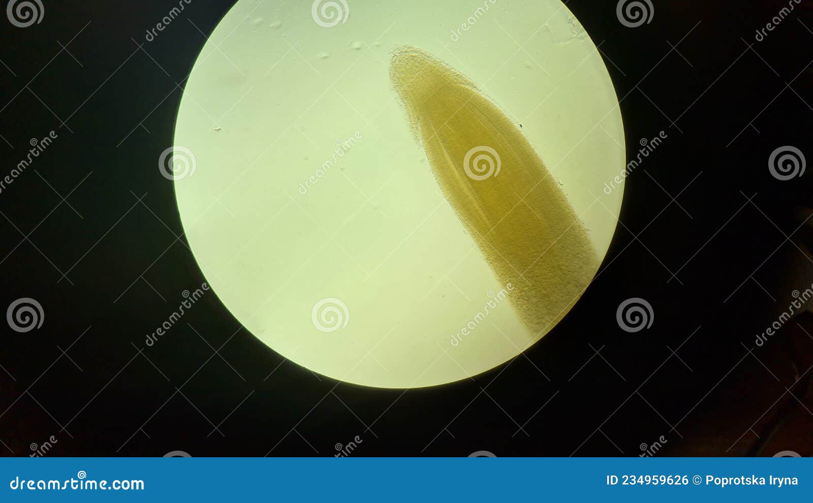 Root Cap in the Field of View of the Microscope Stock Photo - Image of ...