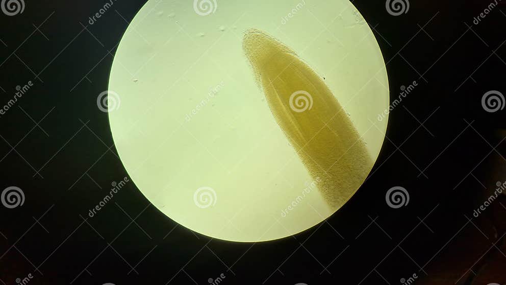 Root Cap in the Field of View of the Microscope Stock Photo - Image of ...