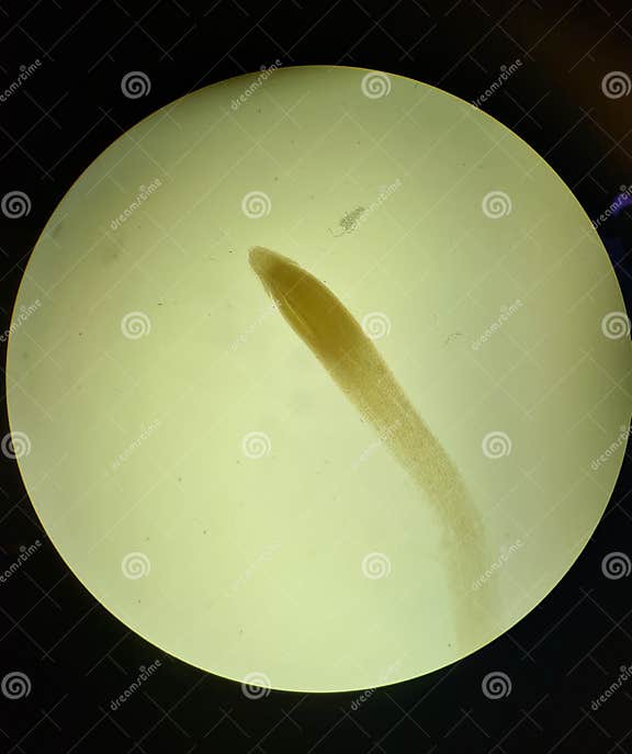 Root Cap in the Field of View of the Microscope Stock Image - Image of ...
