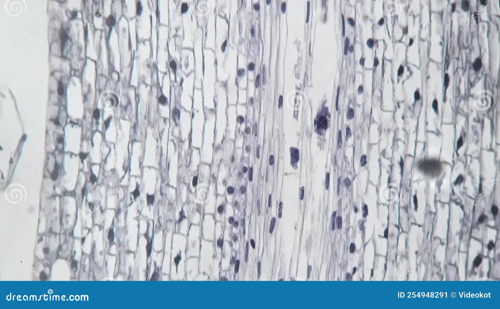 Root Tip of Allium Cepa in Longitudinal Section Magnified by Microscope ...