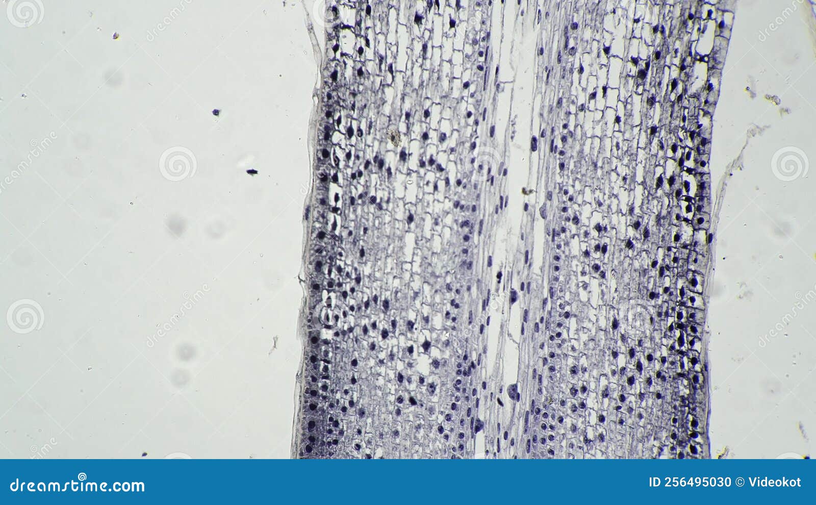 Root Tip of Allium Cepa in Longitudinal Section Magnified by Microscope ...