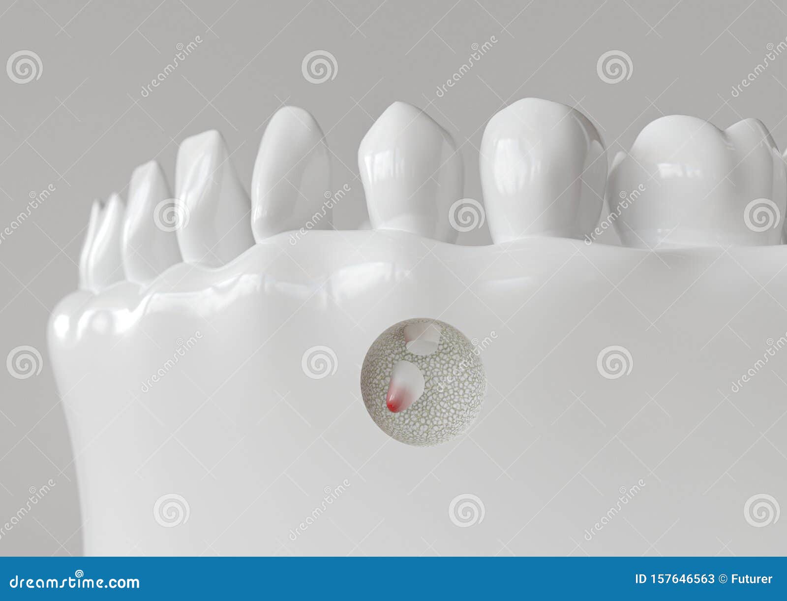 Root Tip Inflammation with Apicectomy - 3D Rendering Stock Illustration ...