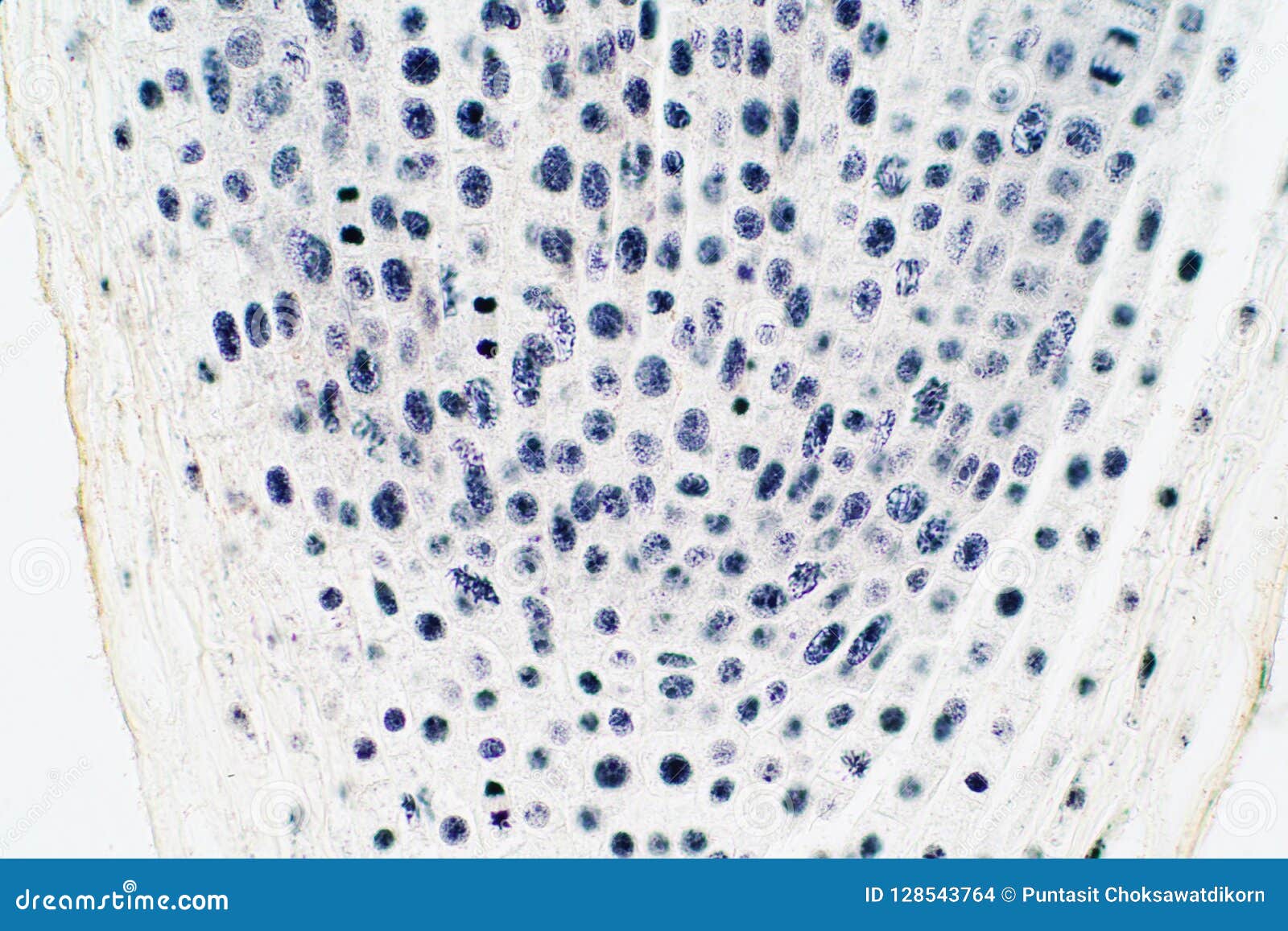 Root Tip of Onion and Mitosis Cell in the Root Tip Stock Photo - Image ...