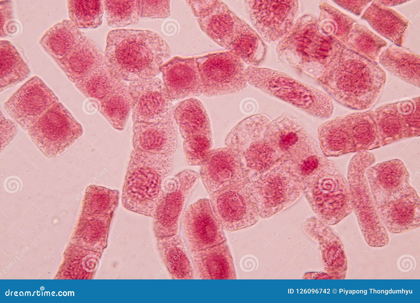 Root Tip of Onion and Mitosis Cell in the Root Tip of Onion. Stock ...
