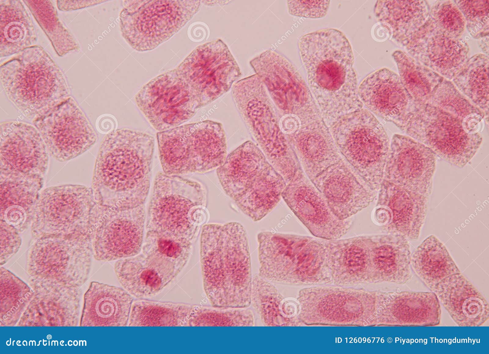 Mitosis Cell In The Root Tip Of Onion Under A Microscope. Royalty-Free ...