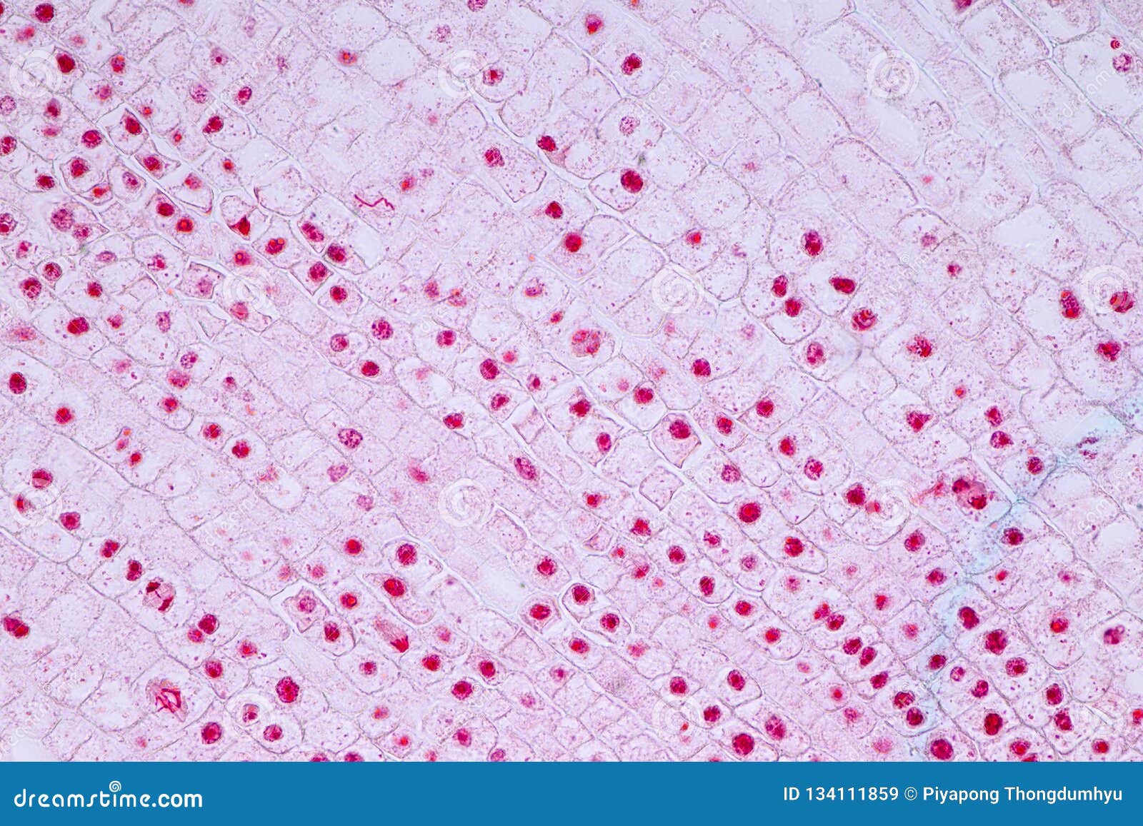Mitosis Cell in the Root Tip of Onion Under a Microscope. Stock Image ...