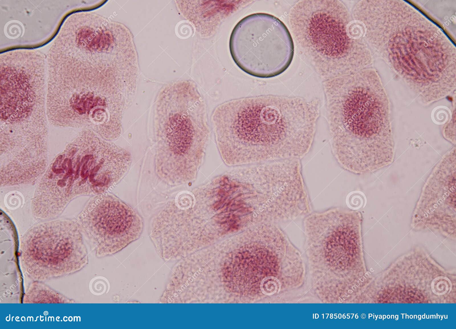 Mitosis Cell in the Root Tip of Onion Under a Microscope. Stock Photo ... Mitosis Cell in the Root Tip of Onion Under a Microscope. Stock Photo ...