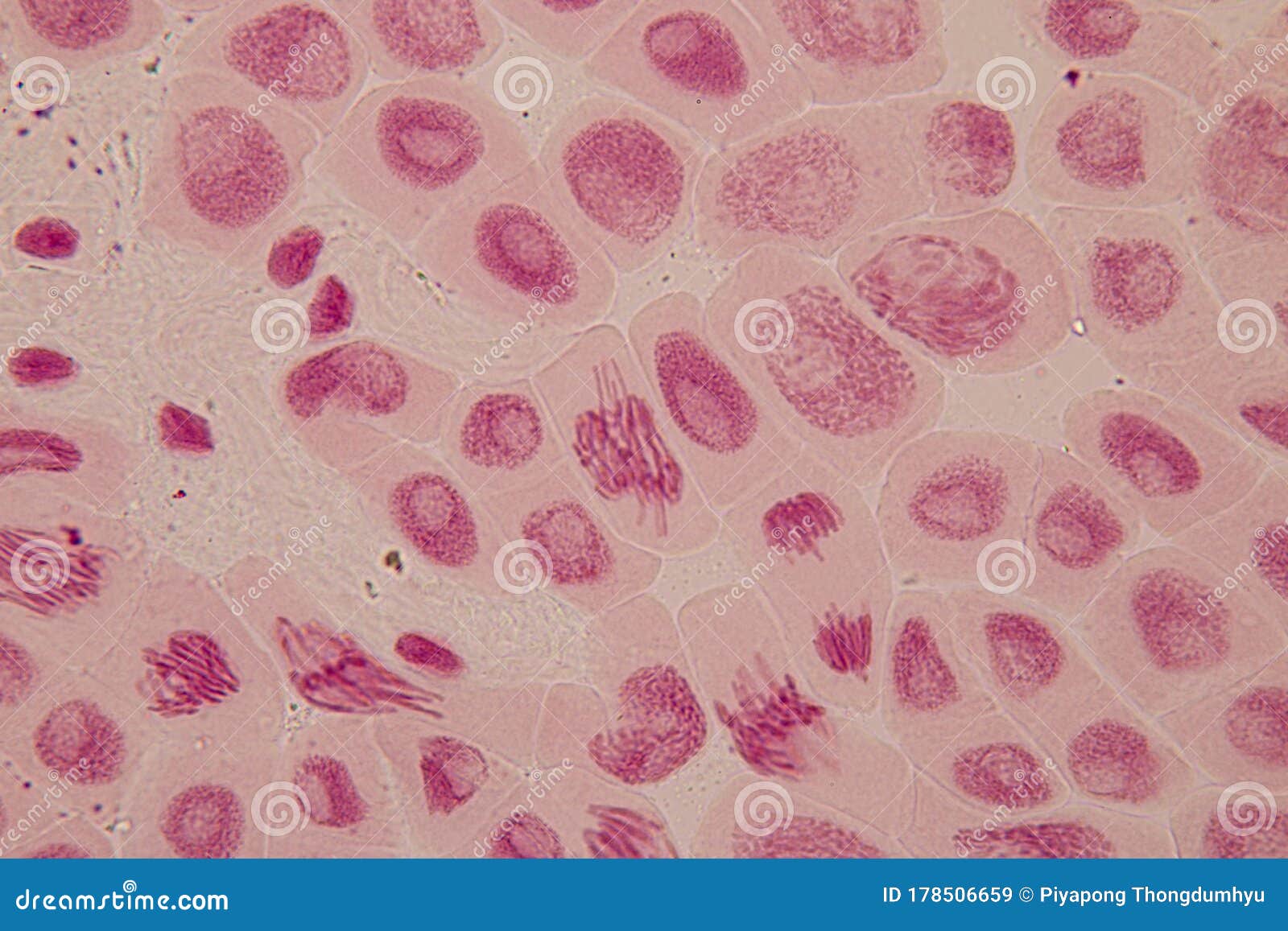 Mitosis Cell in the Root Tip of Onion Under a Microscope. Stock Image ...