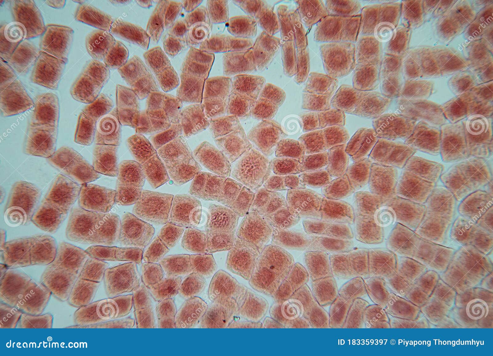 Mitosis Cell in the Root Tip of Onion Under a Microscope. Stock Image ...