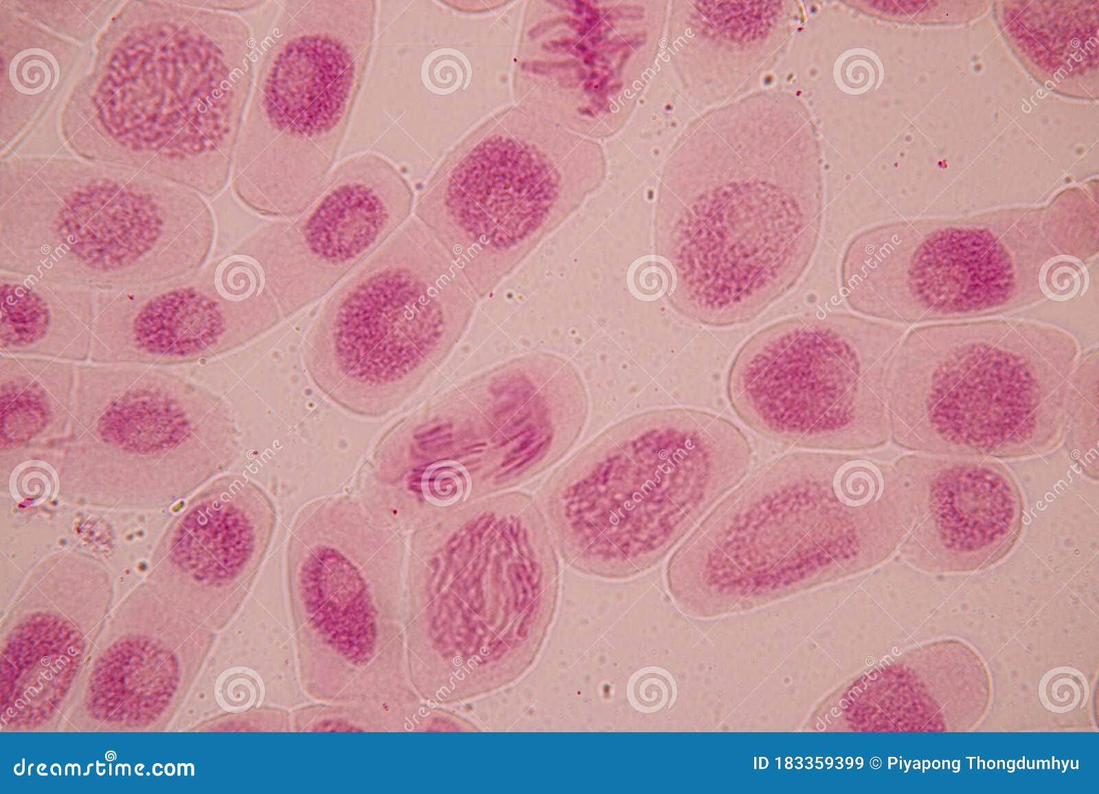 Mitosis Cell In The Root Tip Of Onion Under A Microscope. Royalty-Free ...