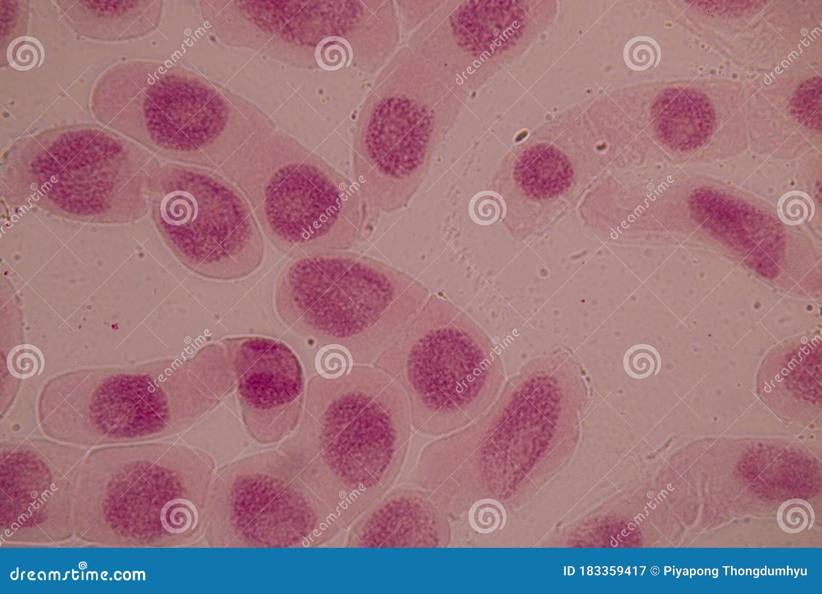 Mitosis Cell In The Root Tip Under The Microscope View Stock ...