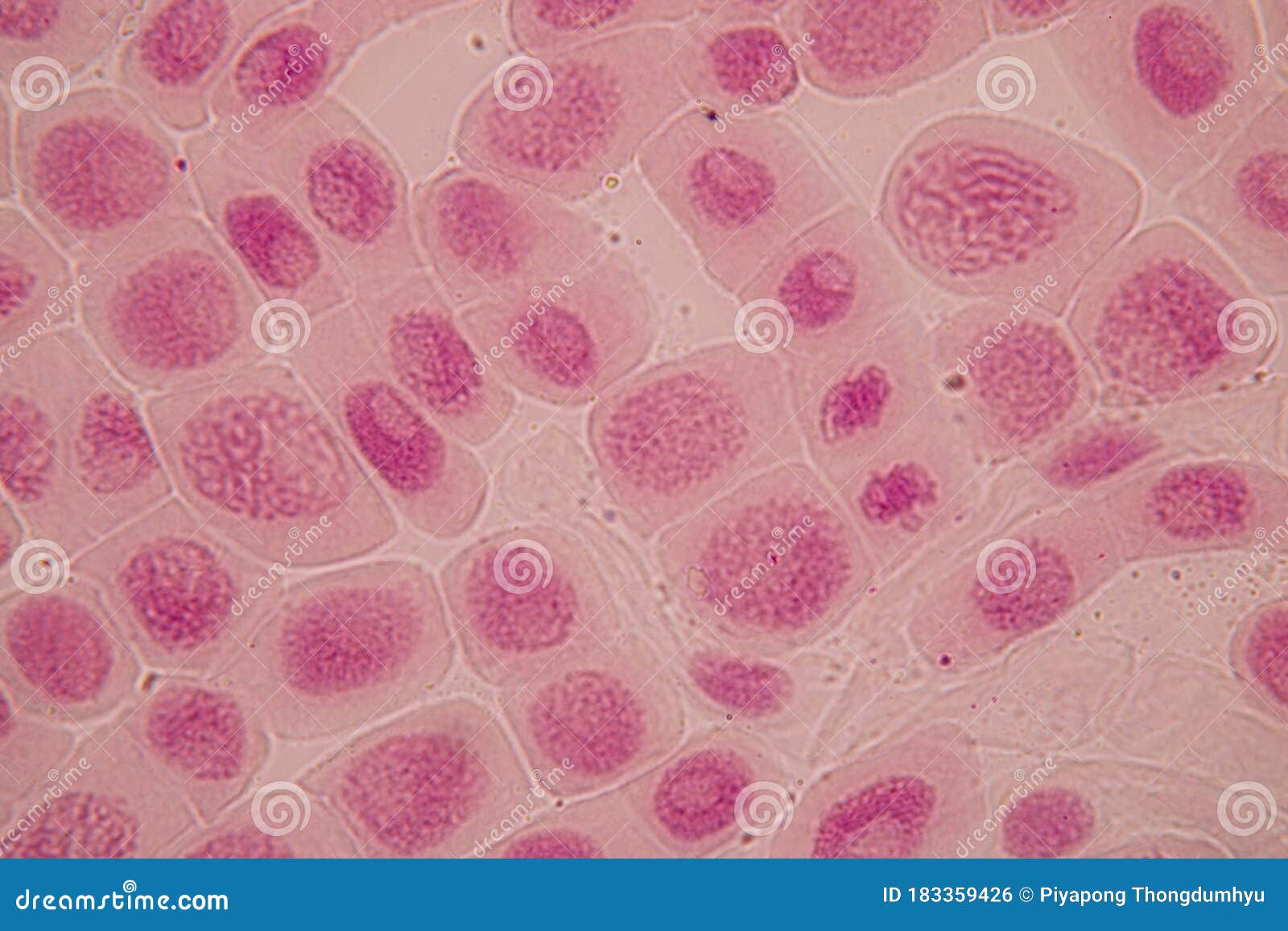 Mitosis Cell in the Root Tip of Onion Under a Microscope. Stock Photo ...
