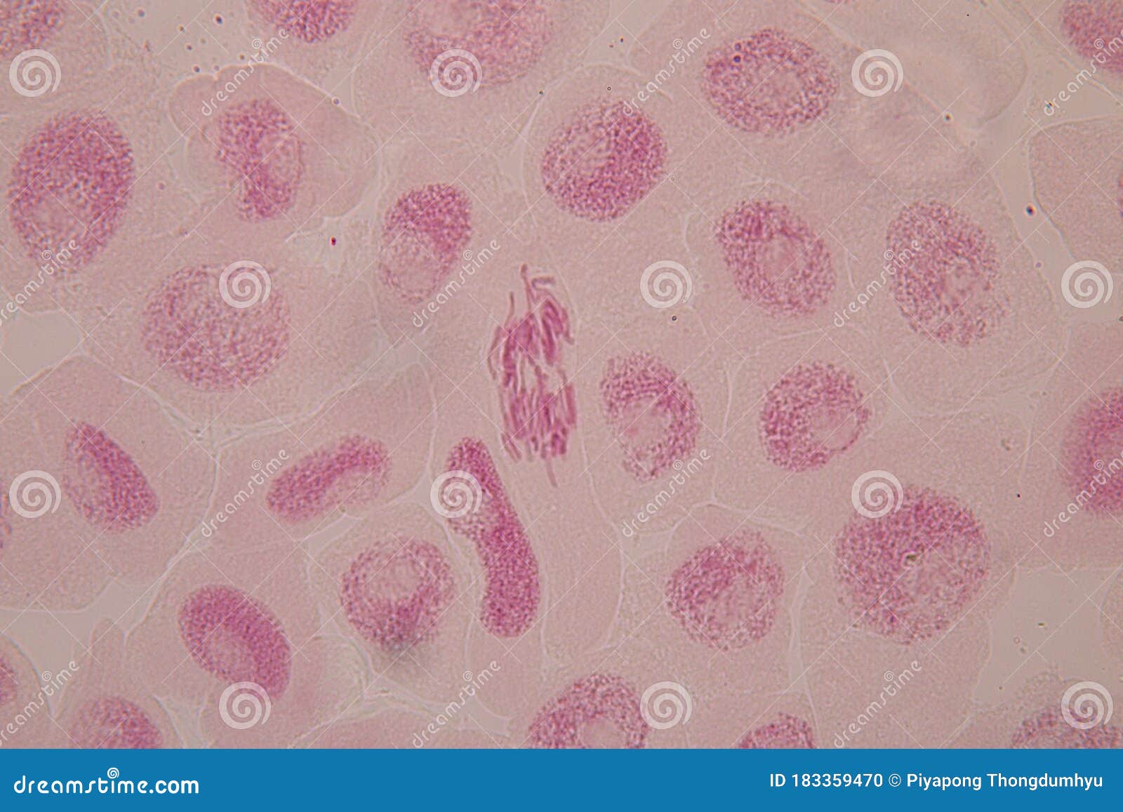 Mitosis Cell in the Root Tip of Onion Under a Microscope. Stock Photo ...