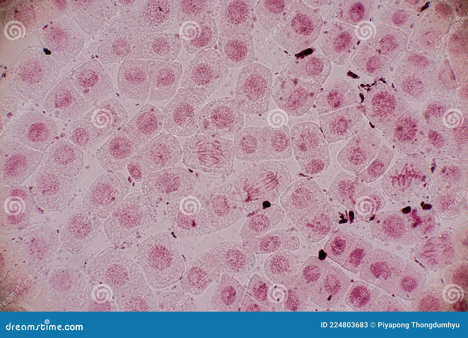 Mitosis Cell in the Root Tip of Onion Under a Microscope. Stock Image ...
