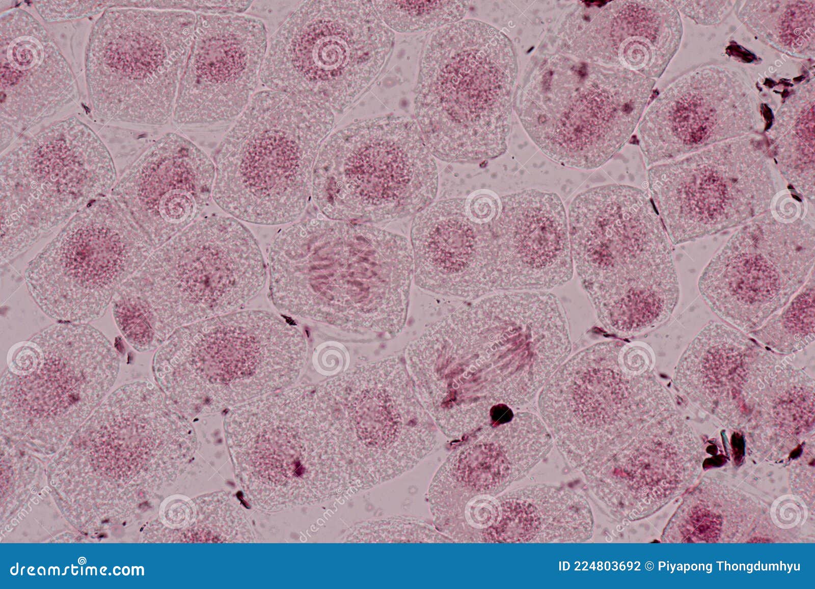 Mitosis Cell in the Root Tip of Onion Under a Microscope. Stock Photo ...