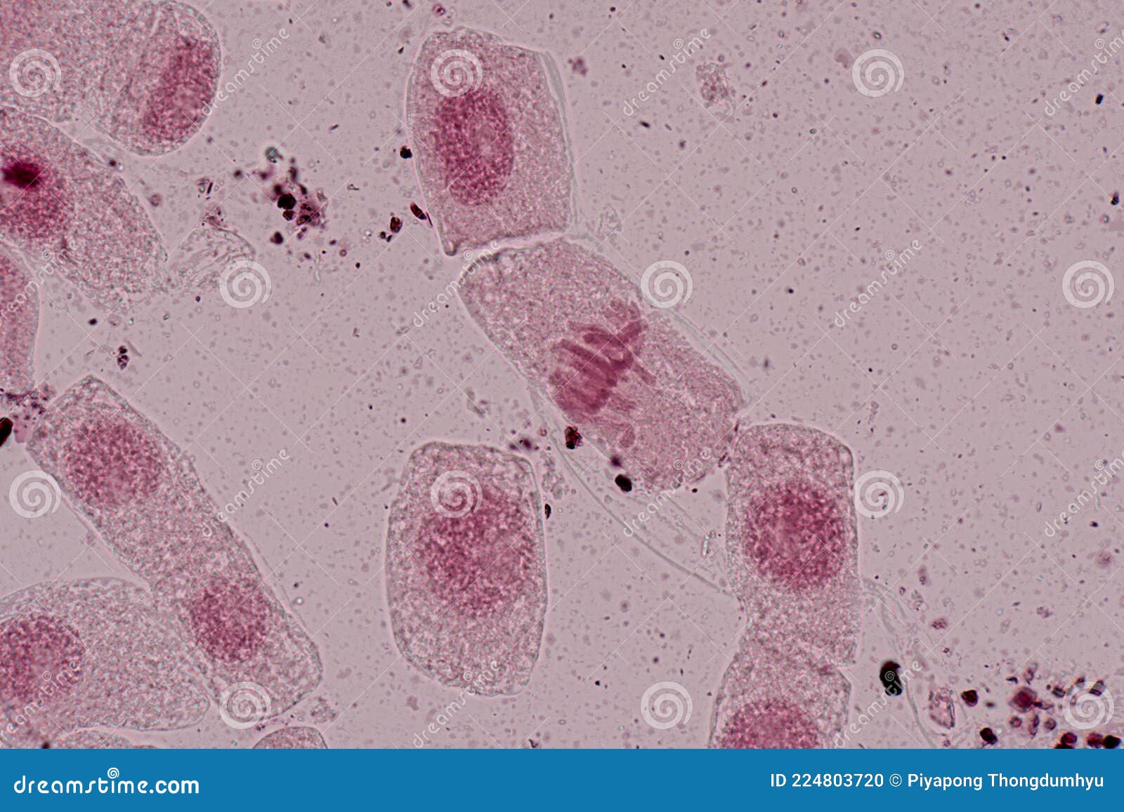 Mitosis Cell in the Root Tip of Onion Under a Microscope. Stock Photo ...