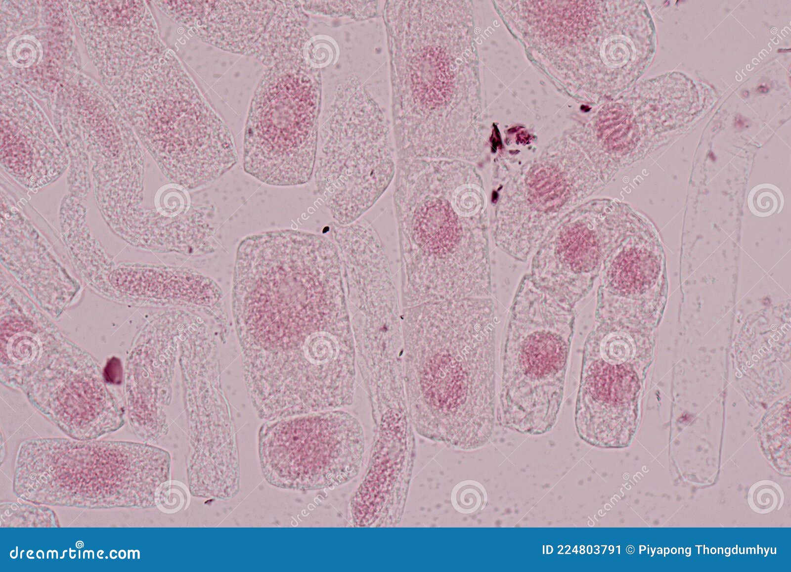 Mitosis Cell in the Root Tip of Onion Under a Microscope. Stock Image ...