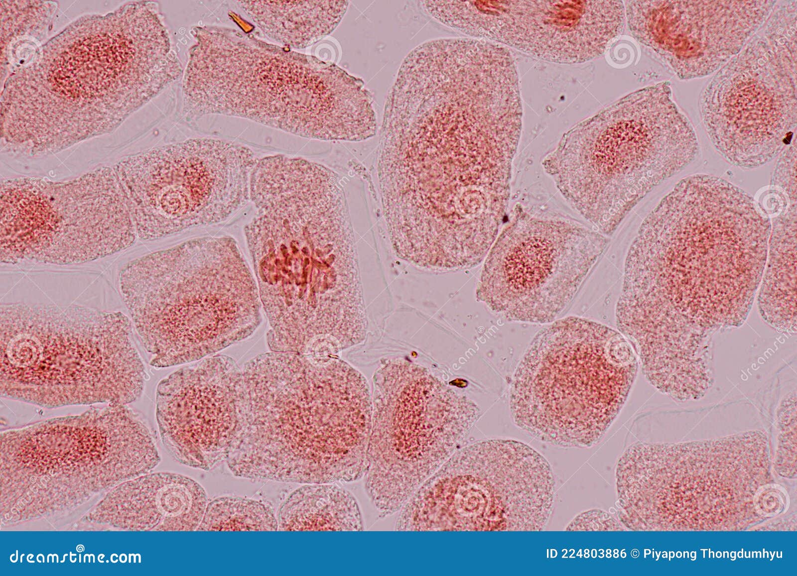 Mitosis Cell in the Root Tip of Onion Under a Microscope. Stock Photo ...