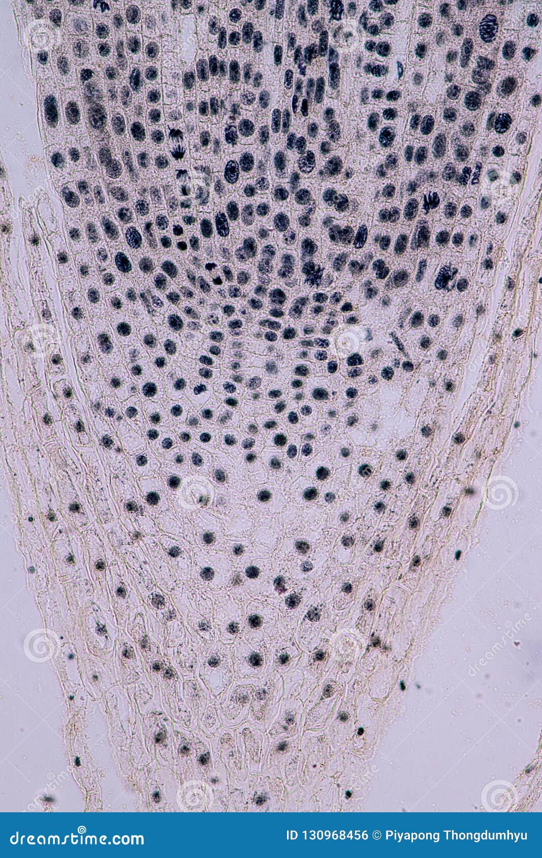 Root Tip of Onion and Mitosis Cell in the Root Tip of Onion Under a ...