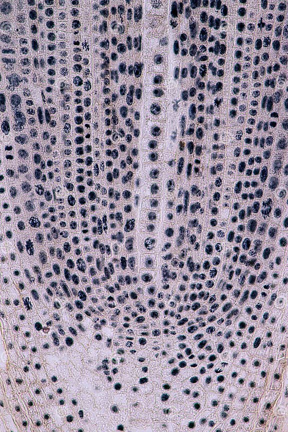 Root Tip of Onion and Mitosis Cell in the Root Tip of Onion Under a ...