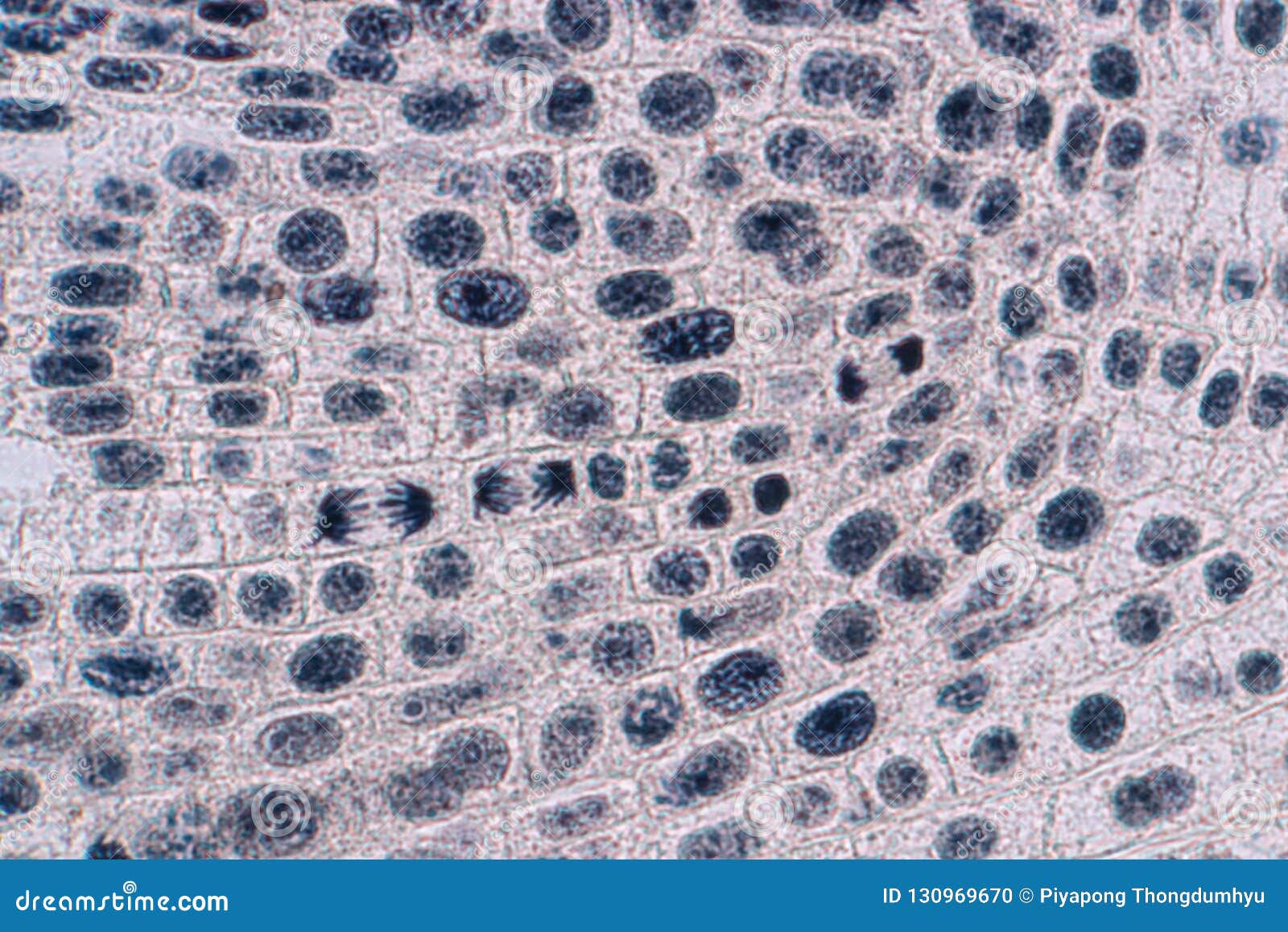 Root Tip of Onion and Mitosis Cell in the Root Tip of Onion Under a ... Root Tip of Onion and Mitosis Cell in the Root Tip of Onion Under a ...