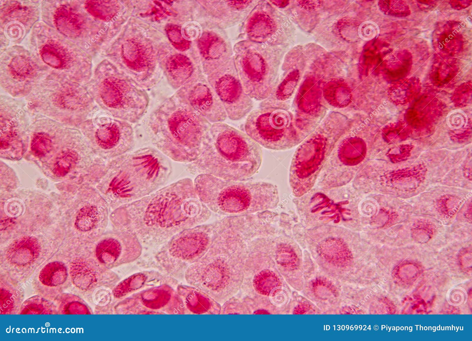 Mitosis Cell In The Root Tip Of Onion Under A Microscope. Royalty-Free ...