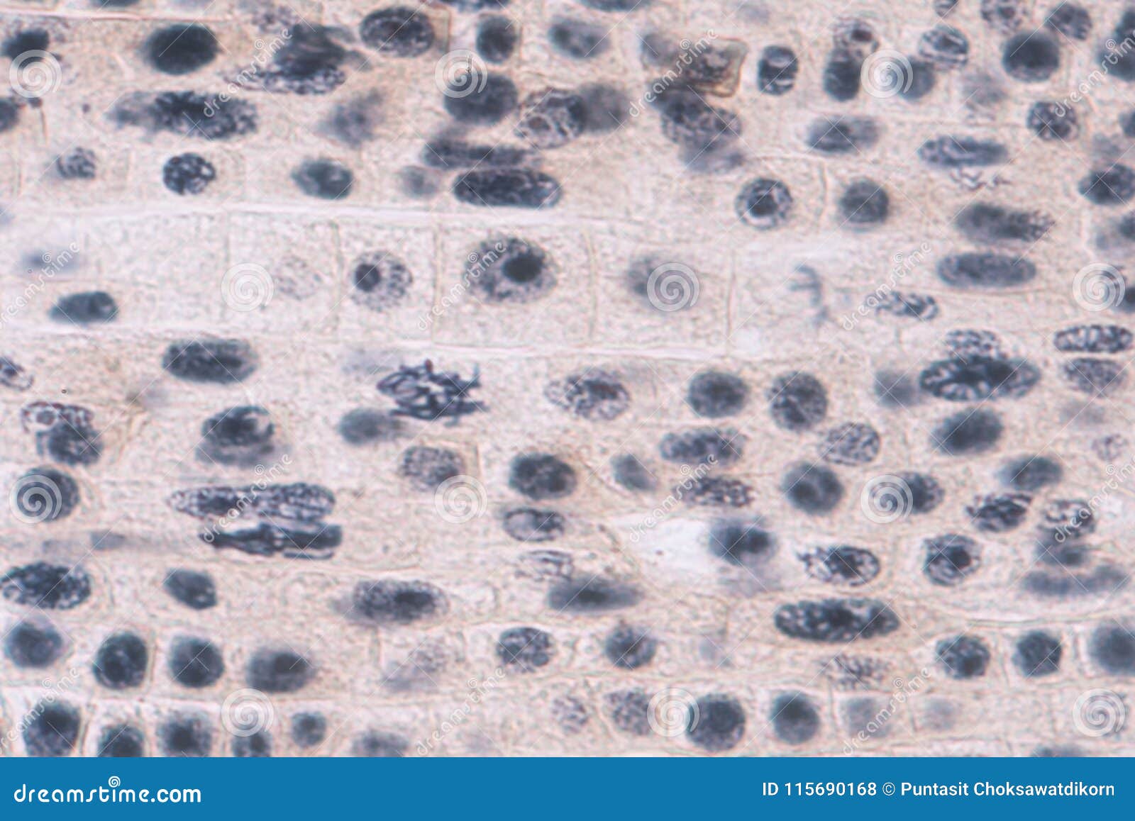 Root Tip of Onion and Mitosis Cell in the Root Tip Stock Photo - Image ...