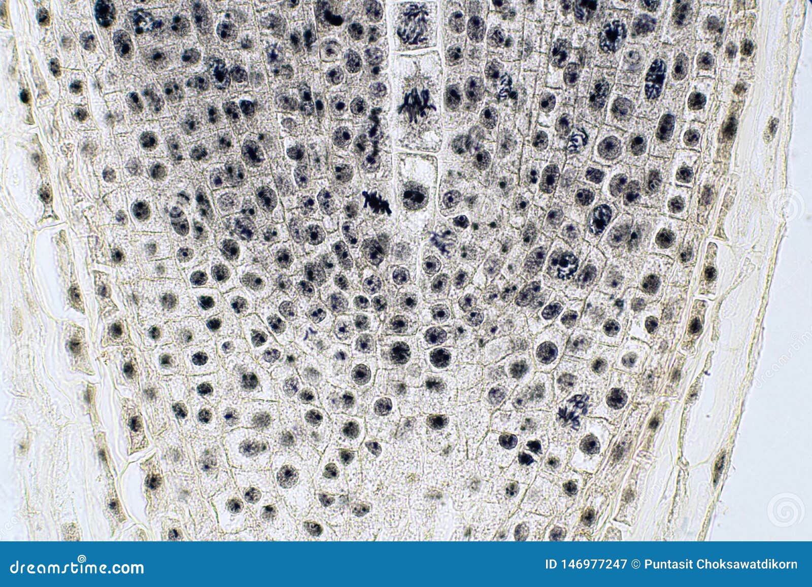 Root Tip of Onion and Mitosis Cell in the Root Tip Stock Image - Image ... Root Tip of Onion and Mitosis Cell in the Root Tip Stock Image - Image ...
