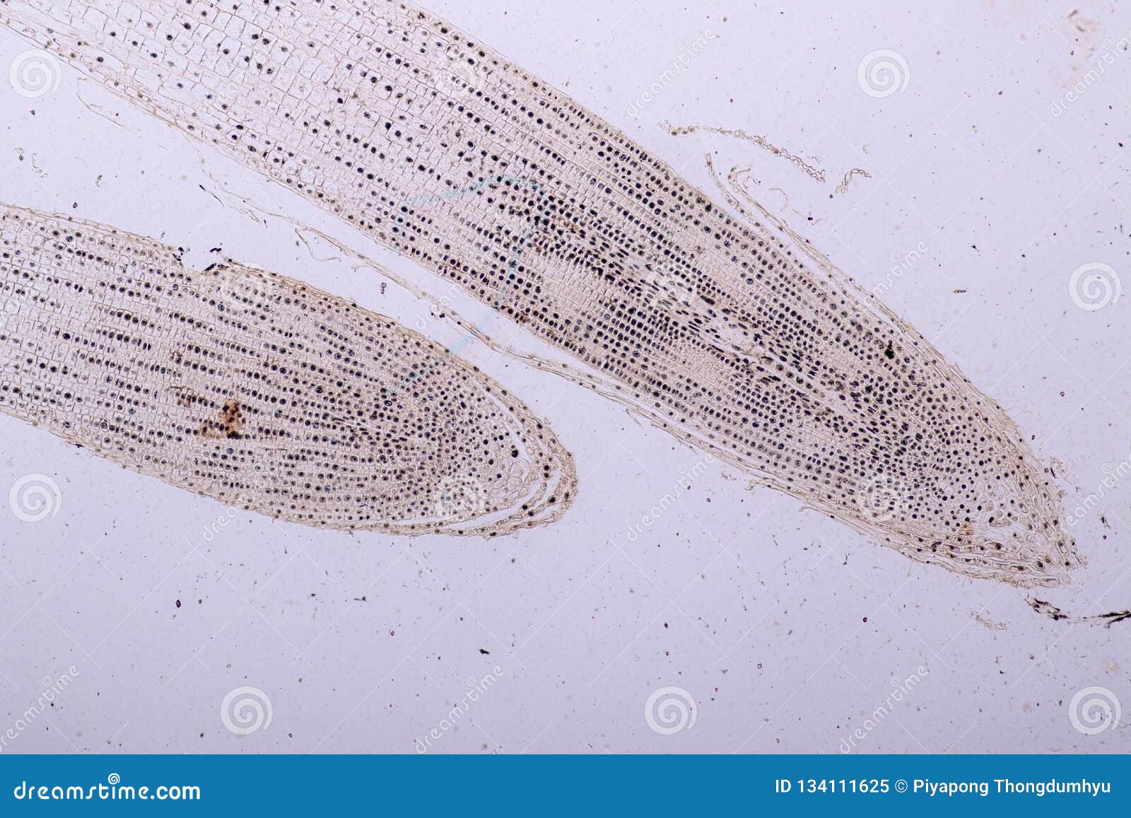 Mitosis Cell in the Root Tip of Onion Under a Microscope. Stock Image ... Mitosis Cell in the Root Tip of Onion Under a Microscope. Stock Image ...