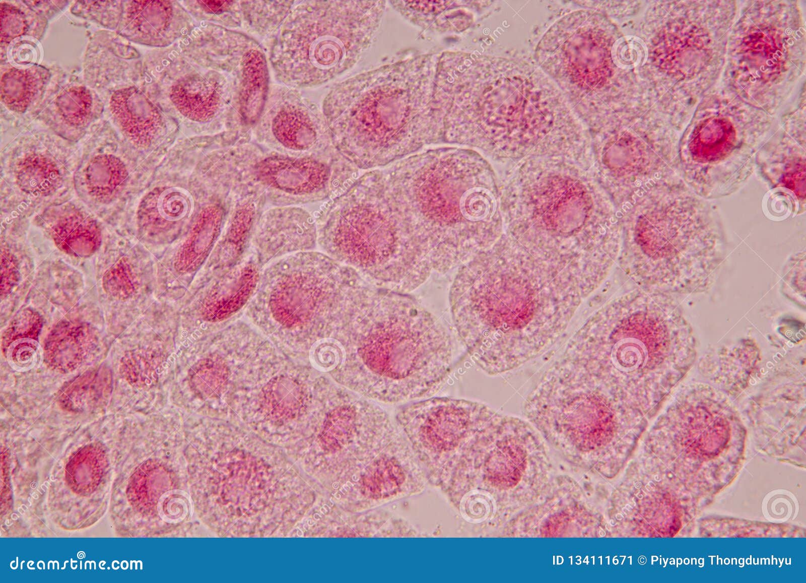 Mitosis Cell in the Root Tip of Onion Under a Microscope. Stock Image ...