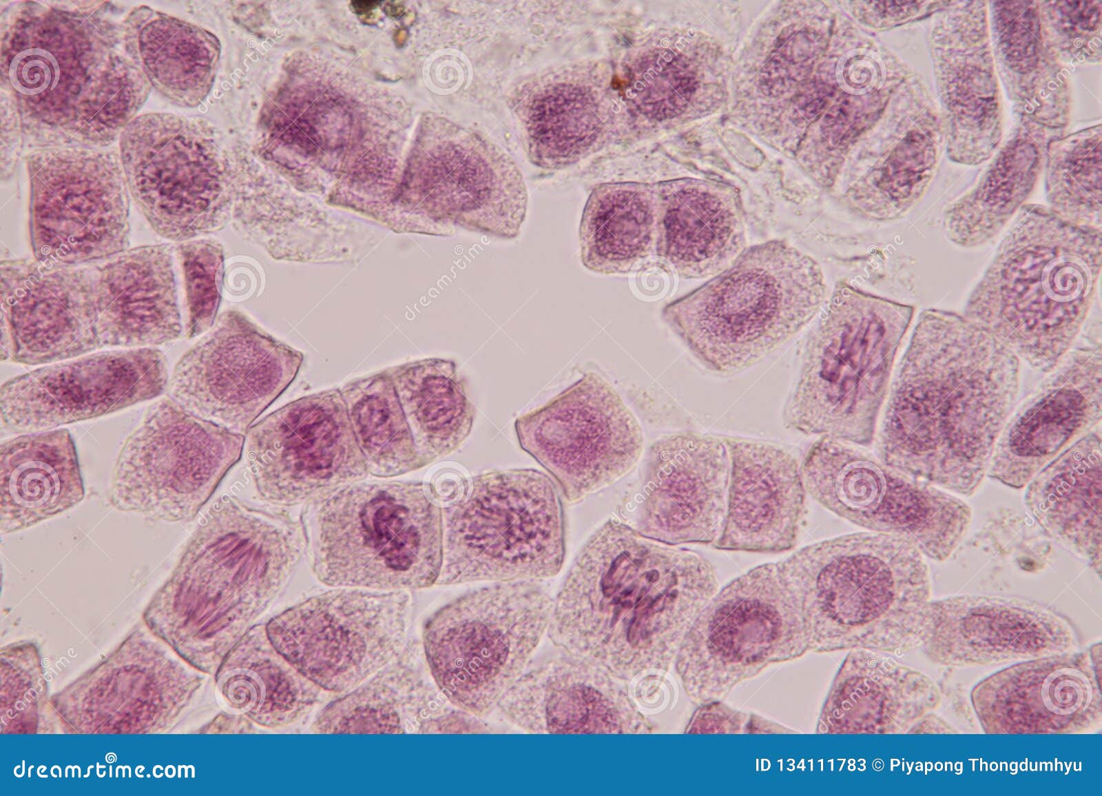 Interphase Mitosis Under Microscope