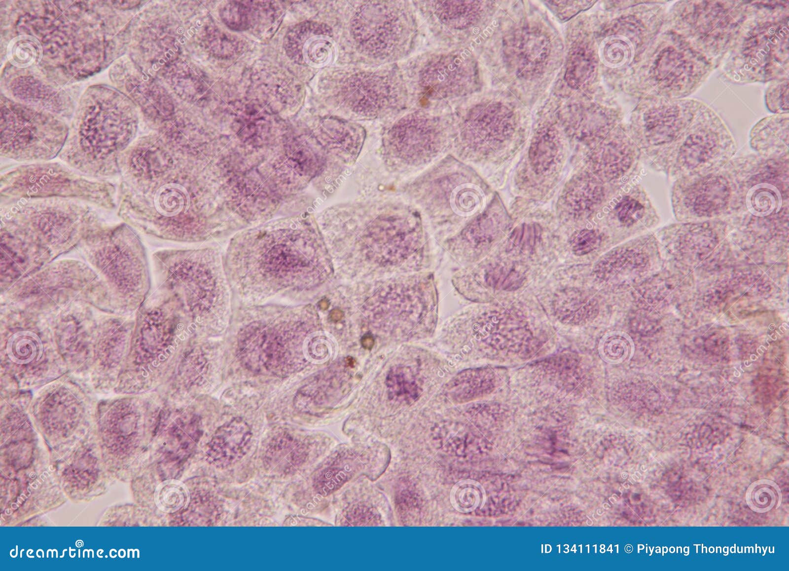 Mitosis Cell in the Root Tip of Onion Under a Microscope. Stock Image ...