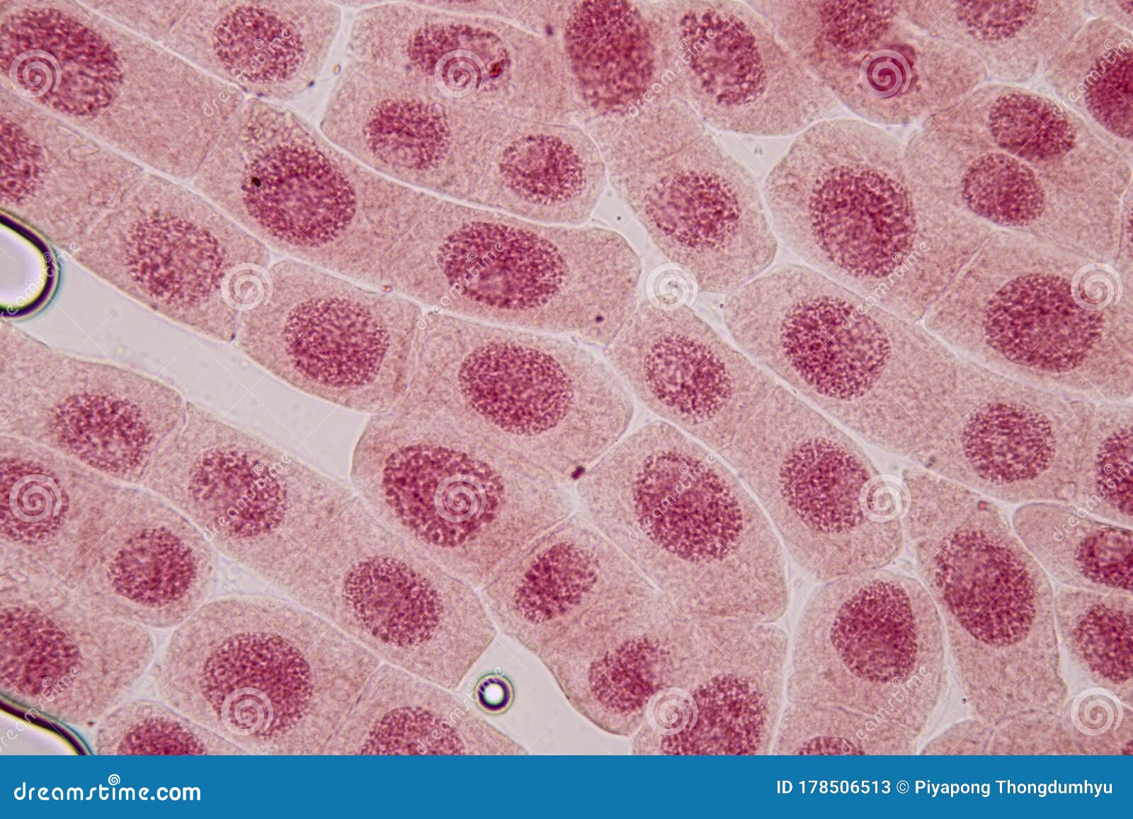 Mitosis Cell in the Root Tip of Onion Under a Microscope. Stock Image ...