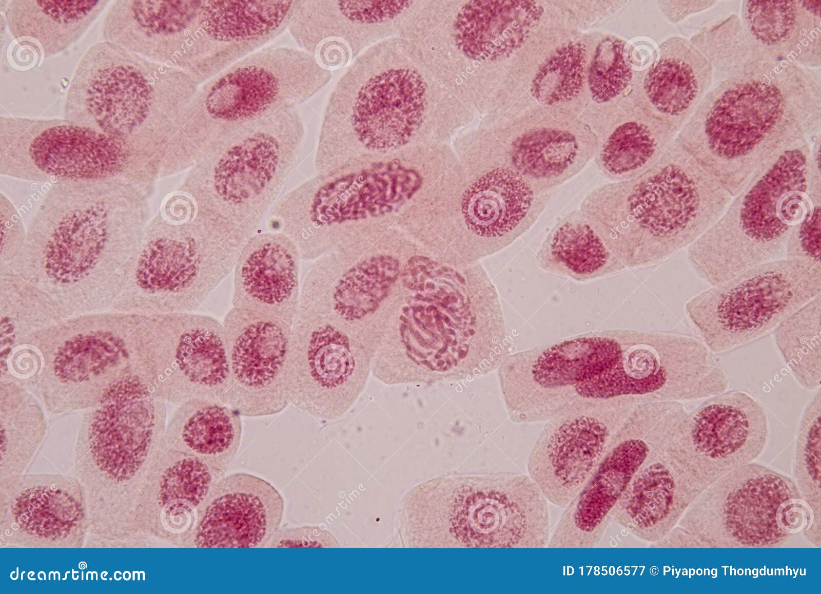 Mitosis Cell in the Root Tip of Onion Under a Microscope. Stock Image ...