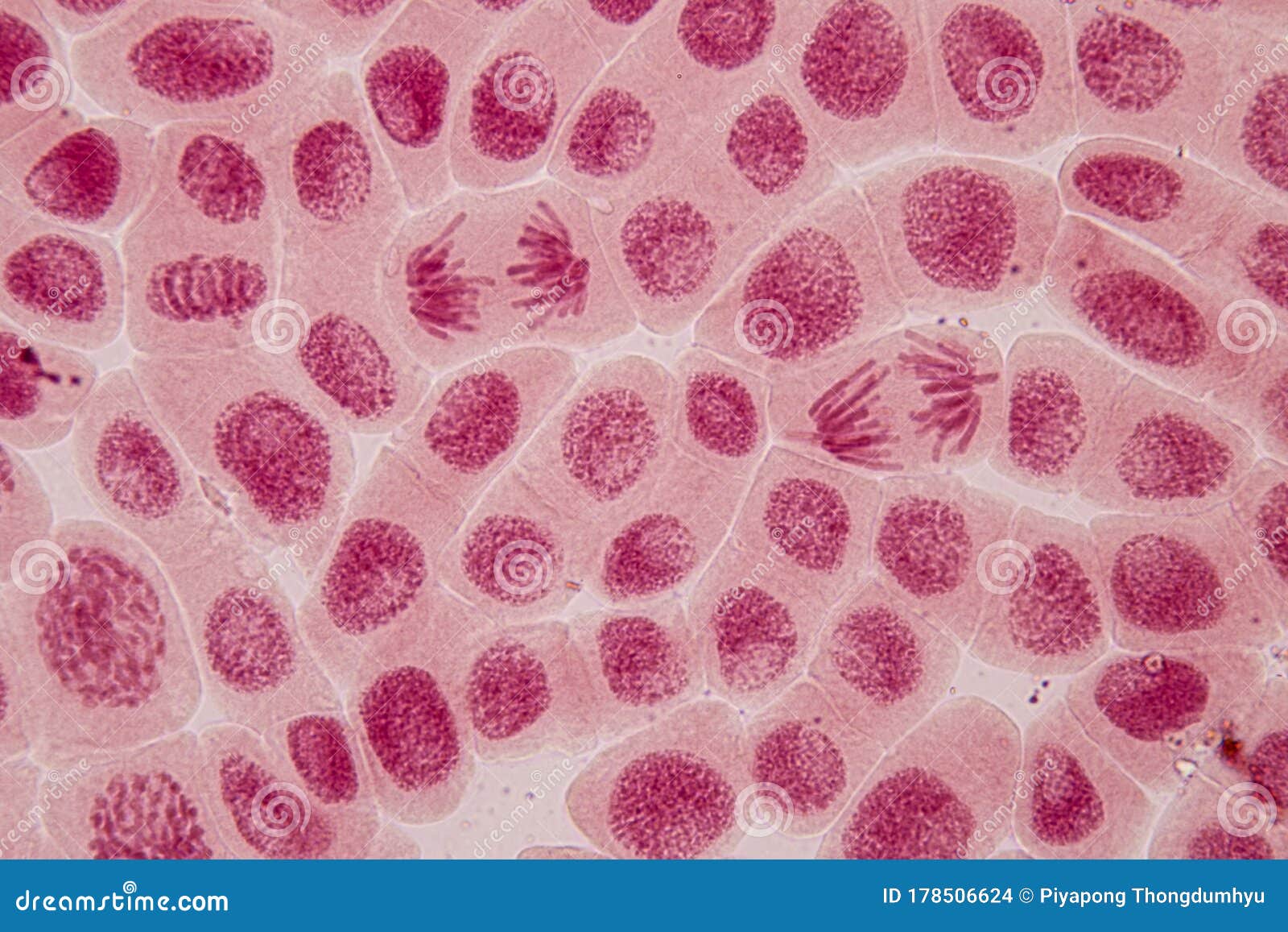 Root Tip Of Onion And Mitosis Cell In The Root Tip Royalty-Free Stock ... Root Tip Of Onion And Mitosis Cell In The Root Tip Royalty-Free Stock ...