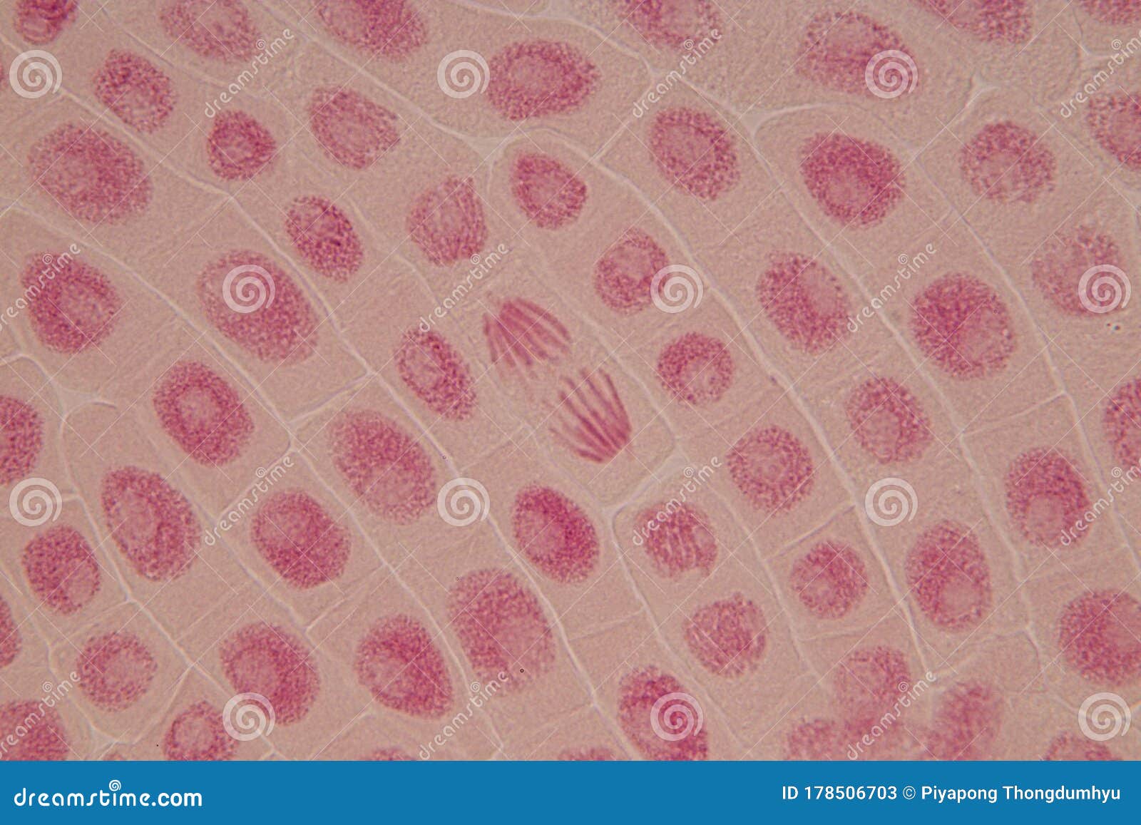 Mitosis Cell In The Root Tip Of Onion Under A Microscope. Stock Image ...